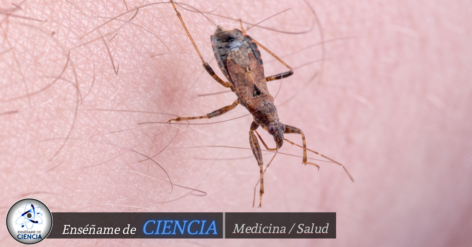 Le Has Visto En Tu Casa Mucho Cuidado Este Insecto Es Transmisor De