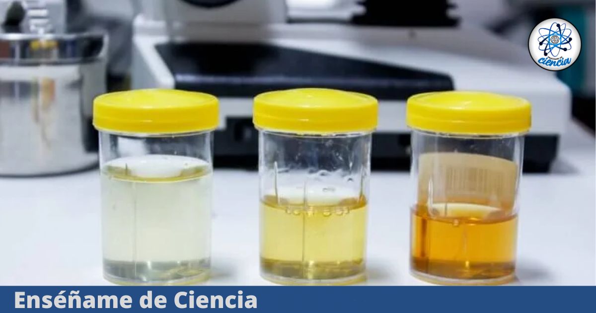 ¿Qué significa cuando la orina sale totalmente transparente, según un ...